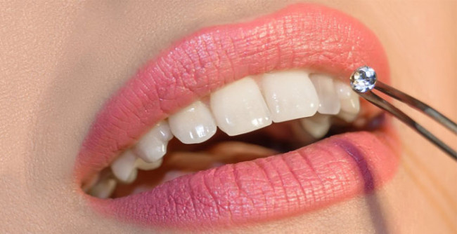 Dental Fashion Trends: Are They Harmful To Your Health?